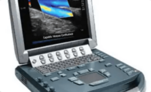 Ultrasound Guided Ablations - The Center Of Mortons Neuroma