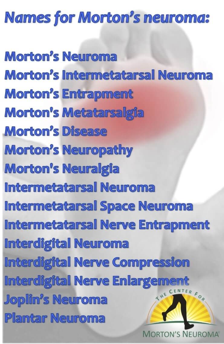 Names for Morton’s neuroma - The Center for Mortons Neuroma