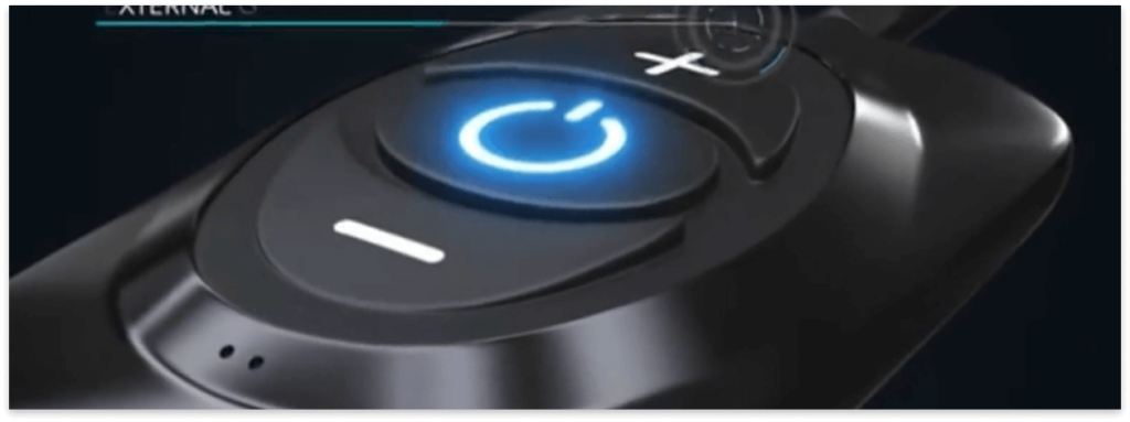 Peripheral Nerve Stimulator for Intractable Morton’s Neuroma